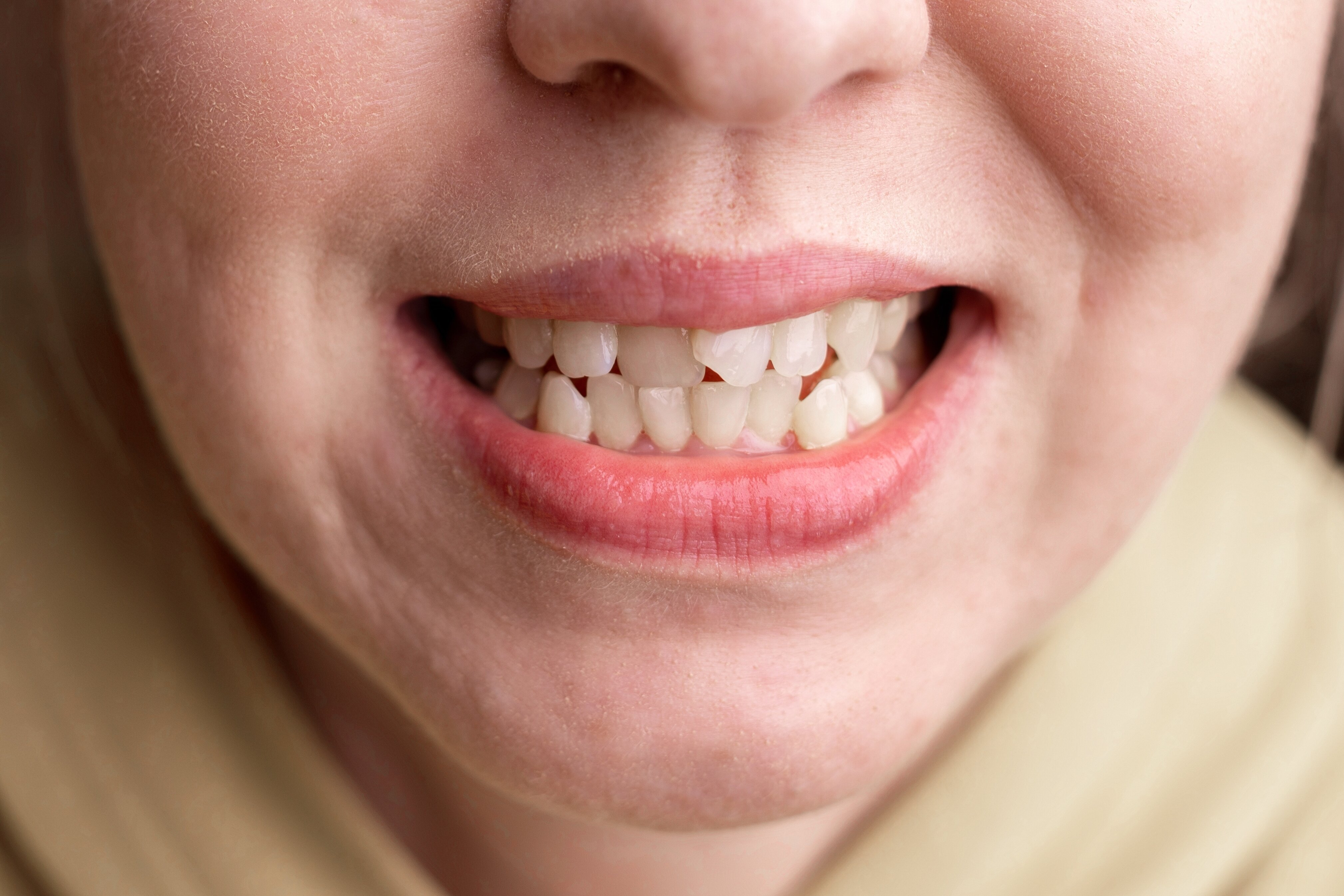 Veneers: Improving Your Teeth's Apperance | Nuffield Dental