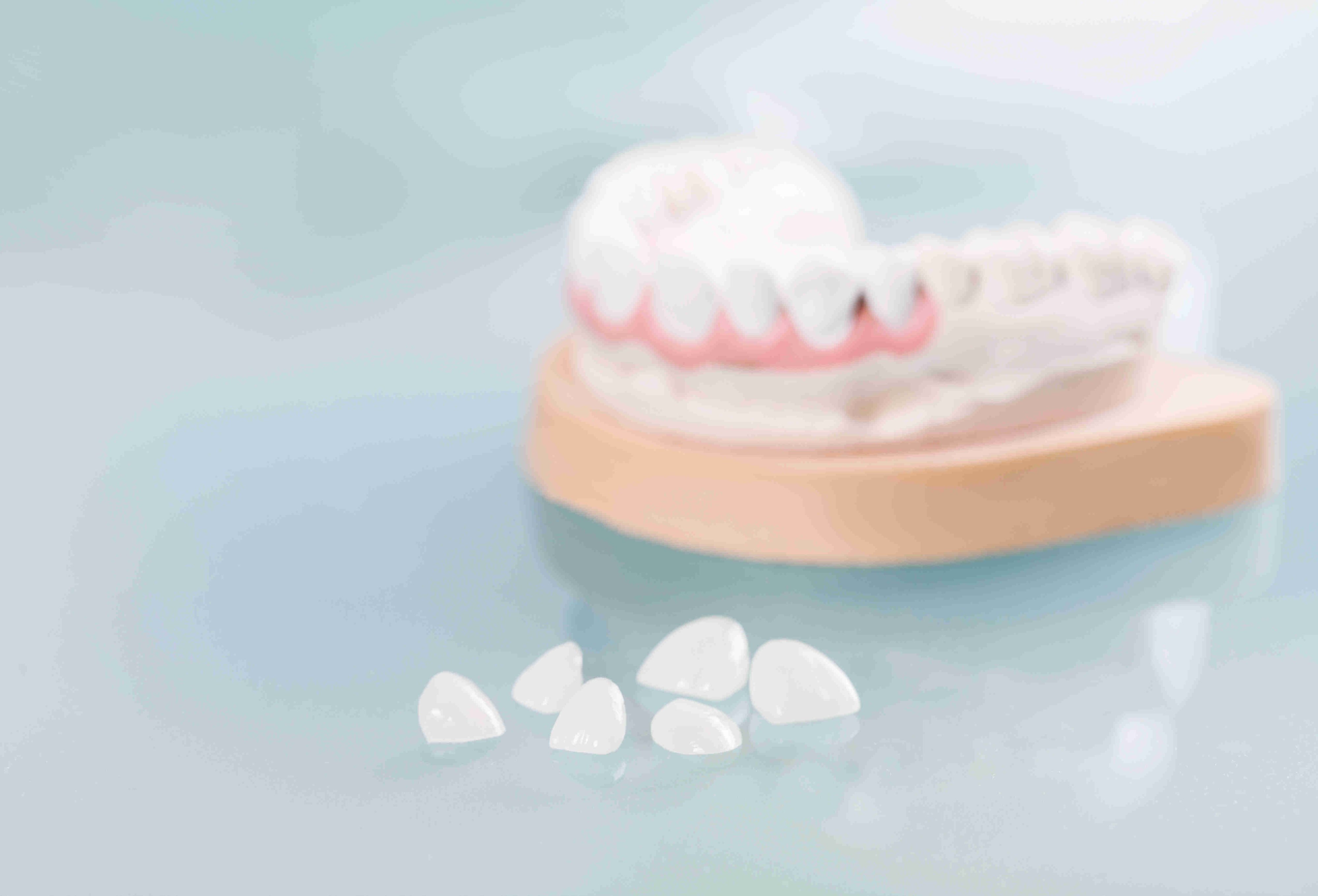 Veneers: Improving Your Teeth's Apperance | Nuffield Dental