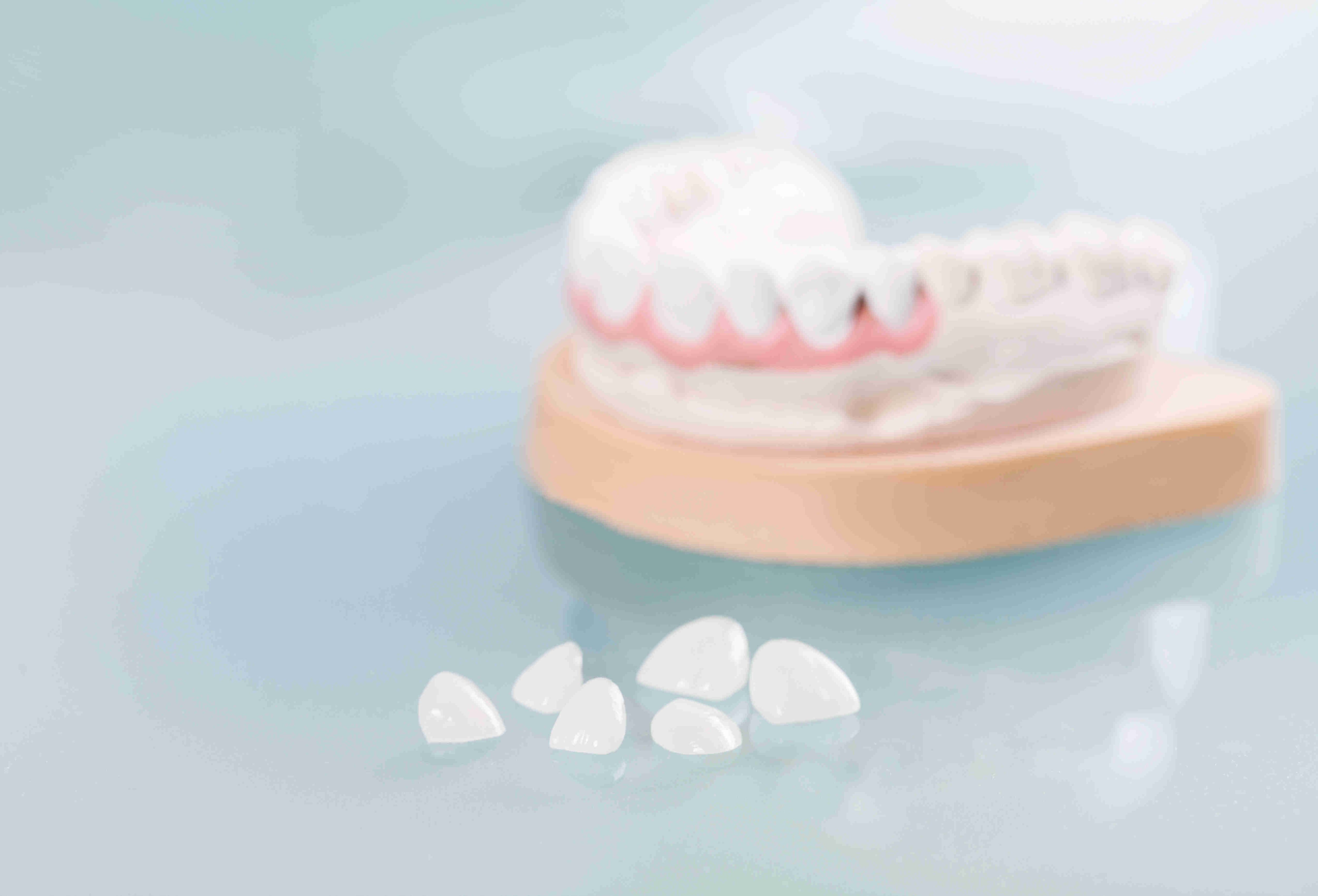 Veneers: Improving Your Teeth's Apperance | Nuffield Dental