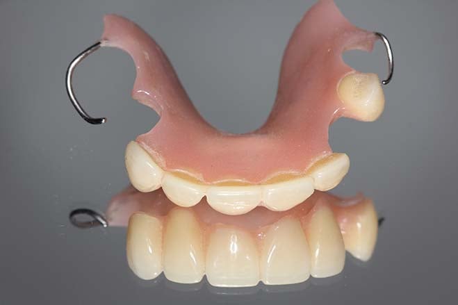 Dentures: A Removable Solution to Missing Teeth | Nuffield Dental