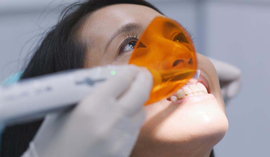 Expert Tips on Emergency Dentist Fillings