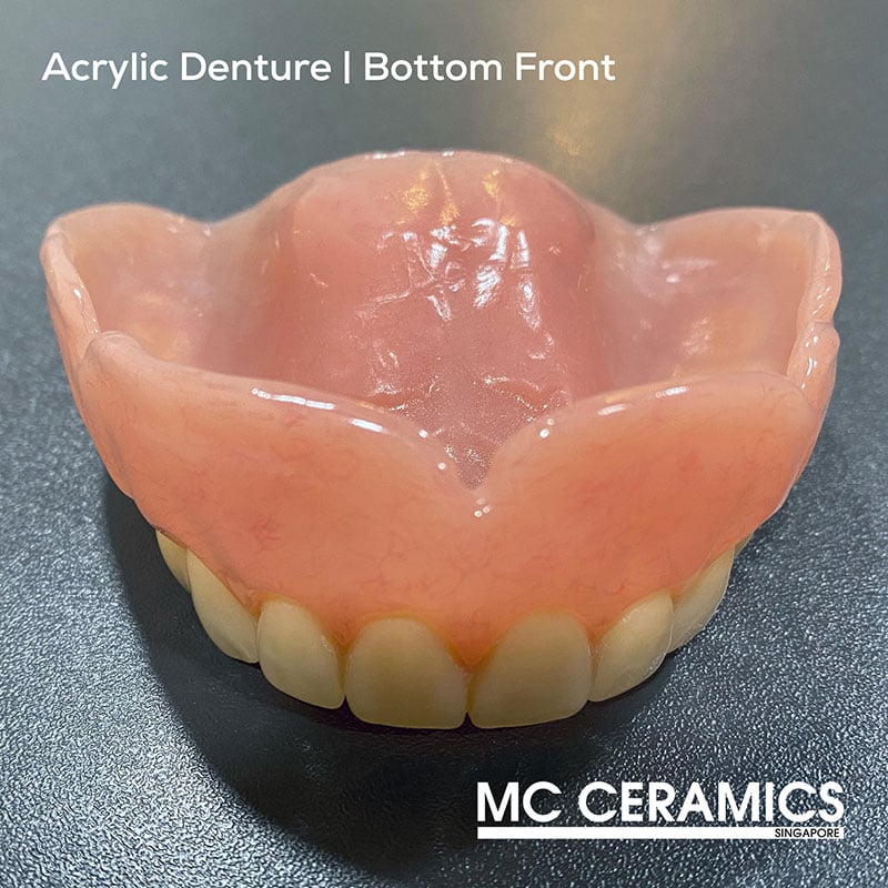 Same Day Dentures At Nuffield Dental