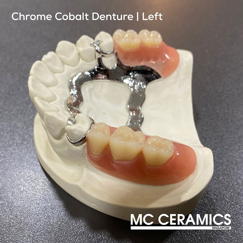 Same Day Dentures At Nuffield Dental
