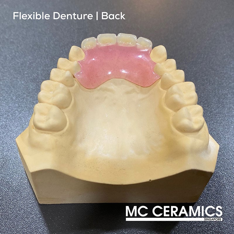 Same Day Dentures At Nuffield Dental